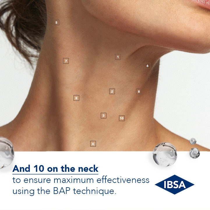 Biostimulator Profhilo